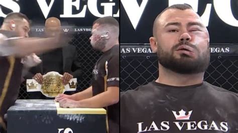 Man Left Brutally Disfigured After 20 Minute Slapping Championship Match