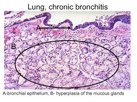 Respiratory System Morphological Characteristics Outcomes And