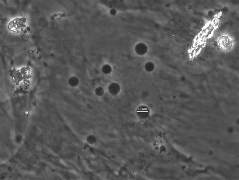 What Could Be These Spherical Structures Among Cells Researchgate