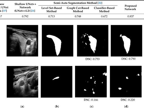 Figure 12 From Thyroid Nodule Segmentation In Ultrasound Image Based On Information Fusion Of