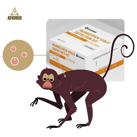 China Monkeypox Virus Rapid Self Test Kit Real Time PCR Reagent Test Kits Monkey Pox Antigen