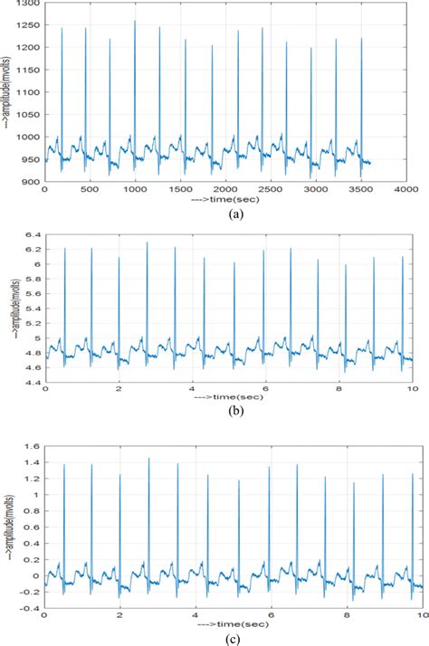 A Raw Ecg Signal With Non Real Time Axis B Ecg Signal With Real Time