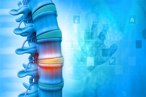 Factors That Affect A Spinal Cord Injury Claim Hollis Law