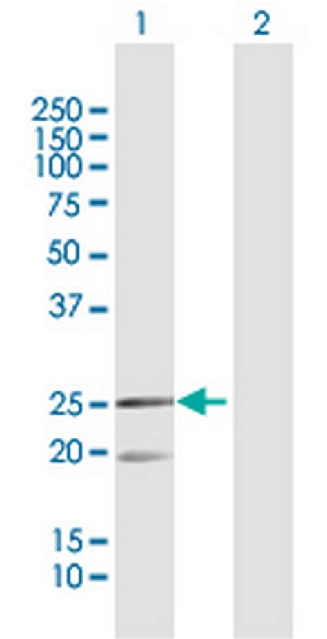 Mrpl12 Polyclonal Antibody H00006182 D01p