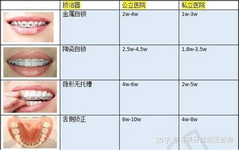 天津戴个牙套多少钱？ 知乎