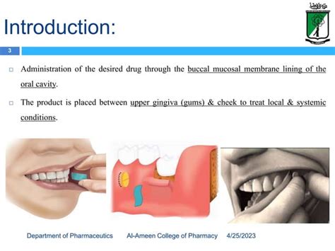 Formulation And Evaluation Of Buccal Drug Delivery System Pptx