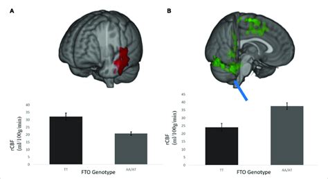 a temporal cluster where rcbf for a carriers