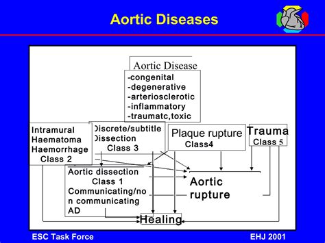 Aortic Ulcer Intramural Hematoma Aortic Dissection Ppt