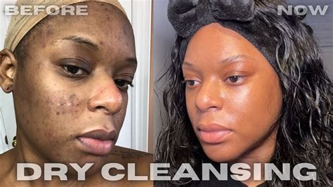 DRY CLEANSING WITH HYPERPIGMENTATION DARK MARKS YouTube