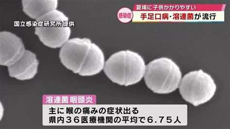 手足口病・溶連菌が流行 夏場に子供がかかりやすい感染症 大分 Tosオンライン