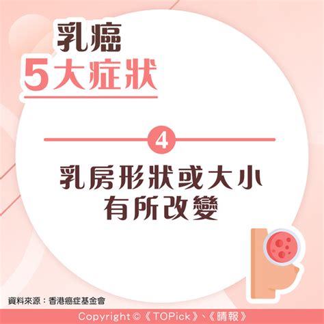 乳癌｜兩孩媽乳癌腫瘤轉移多處 1個心疼原因拖足2年求醫終不治 香港經濟日報 Topick 健康 醫生診症室 D240507