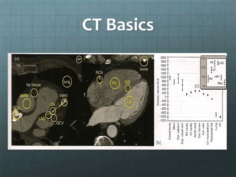 PPT Cardiac CT Basic Principles PowerPoint Presentation Free Download ID