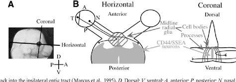 Figure 1 From Retinal Ganglion Cell Axon Guidance In The Mouse Optic