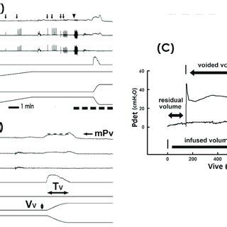 PDF Pressure Volume Loop Analysis Of Voiding Workload An Application In Trans Vaginal Mesh