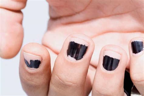 8 Razones Por Las Que Tienes Uñas Quebradizas Mejor Con Salud