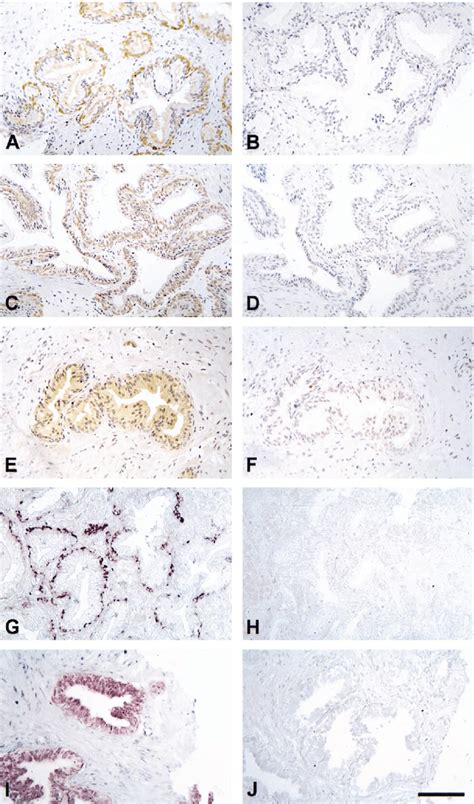 Localization Of C And N Inhibin Protein And Inhibin Subunit Mrna In