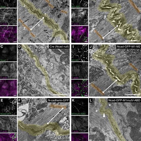 N Cadherin Gfp E Catenin Fusions Selectively Recruit Ligands To Download Scientific Diagram