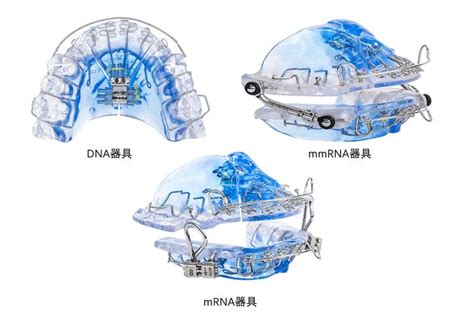 Fda批准vivos的口腔矫治器用于治疗重度阻塞性睡眠呼吸暂停 知乎