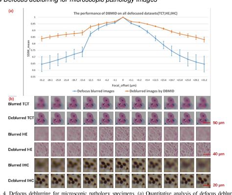 figure 1 from blind deblurring for microscopic pathology images using