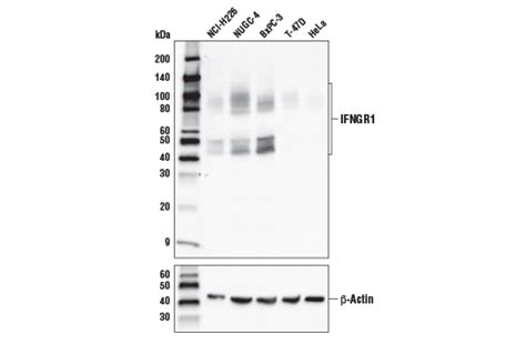 Ifngr1 Antibody Cell Signaling Technology