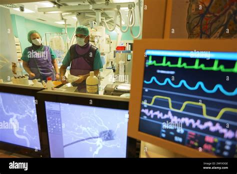 Cerebral Aneurysm Embolization Willis Polygone Angiography Monitoring Interventional