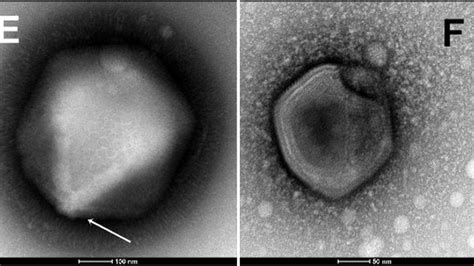 Zombie Virus Reanimated After 50000 Years In Siberian Permafrost