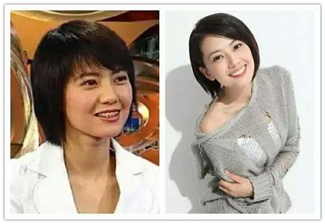 矫正牙齿有美容作用吗 知乎