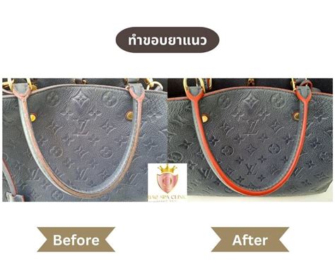 ยาแนวเหนียว ขอบพัง ปัญหาเหล่านี้ แวะมาหา 👇 Bag Spa Clinic พร้อมจะ