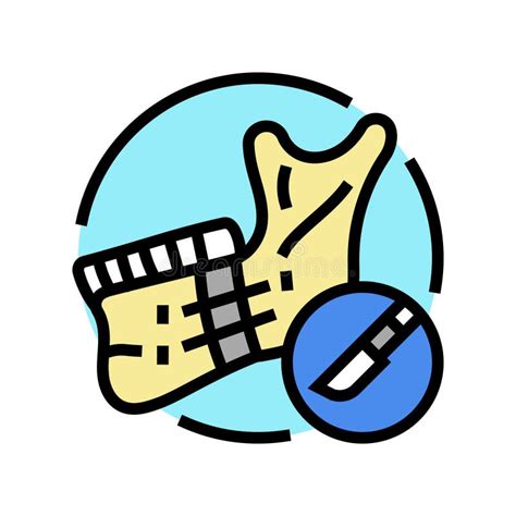 Mandibular Osteotomy Surgery Color Icon Vector Illustration Stock