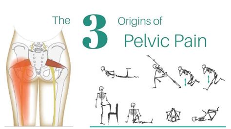3 Types Of Pain In The Butt And What You Can Do About Them Artofit