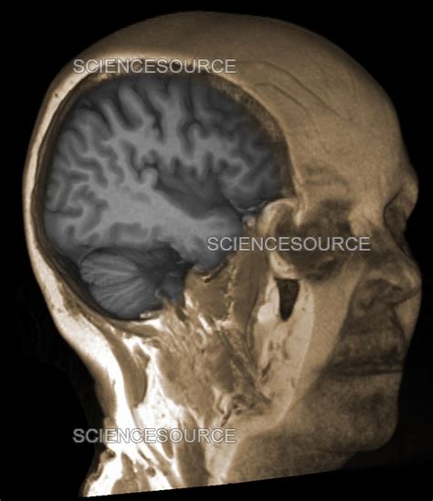 normal brain 3d mri stock image science source images
