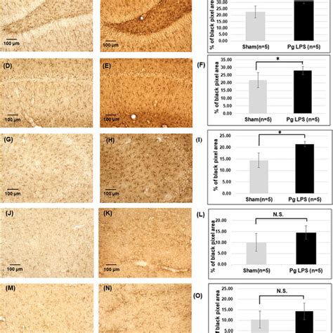 Immunoreactivity For Gfap In The Hippocampus And The Prefrontal Cortex