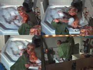 Naked Pat Priest In The Incredible Headed Transplant