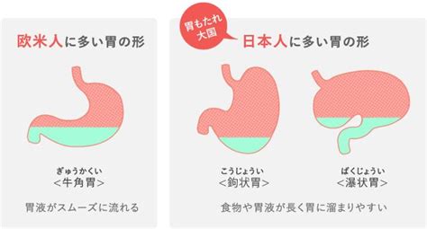 【胃がムカムカ】胃もたれの原因・治し方を医師が解説 Doctors Meドクターズミー Words Word Search