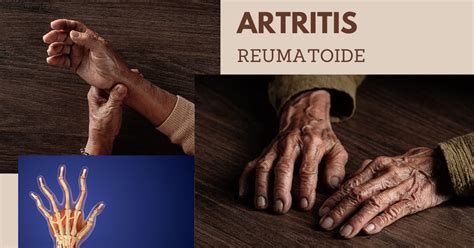 Artritis Reumatoide Sintomas Y Causas El Salvador Redes De Salud En El Salvador 1