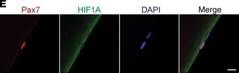 Hif 1 Alpha Antibody H1alpha67 Nb100 105 By Novus Part Of Bio Techne