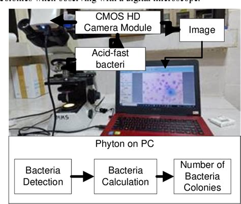 Figure 1 From Enhancing Accuracy In Mycobacterium Tuberculosis Counting On Acid Fast Bacteria