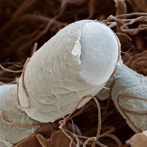 Sand Flea Egg Sem Stock Image Z3750117 Science Photo Library