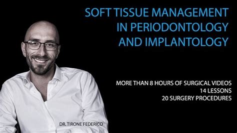 Soft Tissue Management In Periodontology And Implantology Online