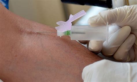 Understanding Calcium Importance And Blood Testing Urology Specialist