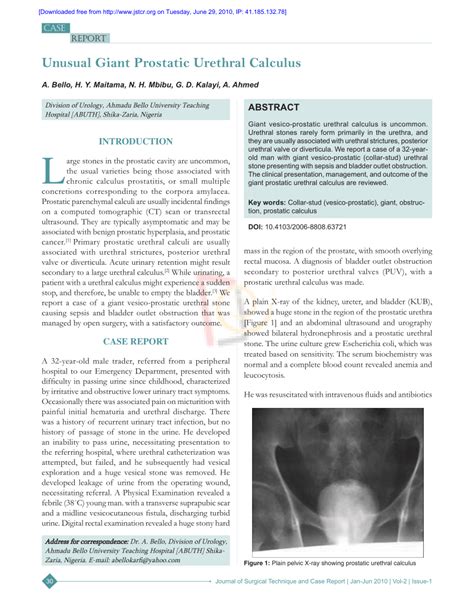 Pdf Unusual Giant Prostatic Urethral Calculus