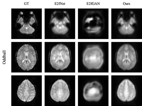 Spec2volcamu Net A Spectrogram To Volume Model For Eeg To Fmri