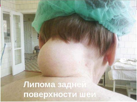 Раны презентация доклад проект скачать