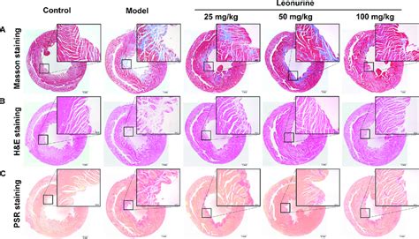 Leonurine Reduced The Area Of Cardiac Fibrosis In Rats With Iso Induced