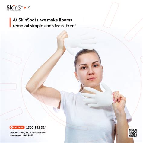 Skin Spots Skin Cancer Doctors 💪 Get Rid Of Lipomas For Smooth Skin 💪