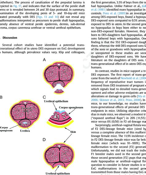 By Way Of Illustrating The Defects Involved In Penile Shaft