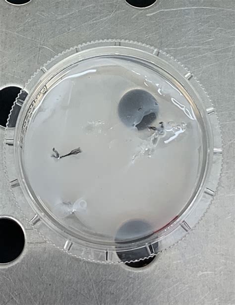 Why Does My Fibrin Gel Created On Smooth Muscle Cells Breaks Up After