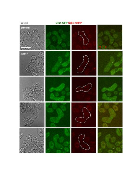 Figure S6 In Vivo Crs1 Gfp And Sid4 Mrfp Localization In Bqt1