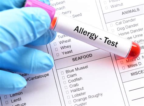 Allergy Testing For Trigger Identification And Relief
