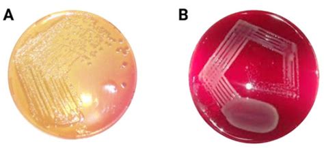 Ochrobactrum Anthropi An Emerging Opportunistic Pathogen In